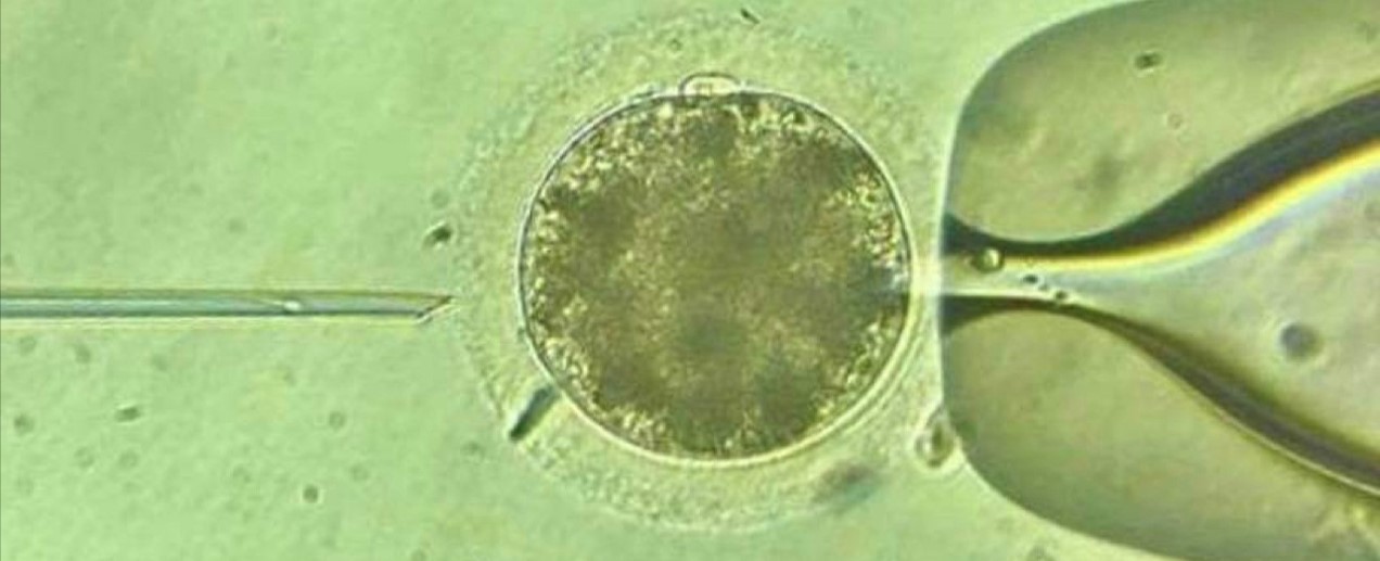 Advancing Equine Reproduction: How ICSI Is Transforming Sport Horse ...